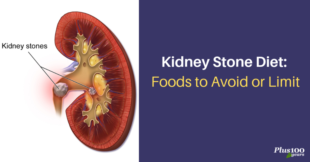Kidney Stone Diet: Food To Avoid Or Limit - Plus100years