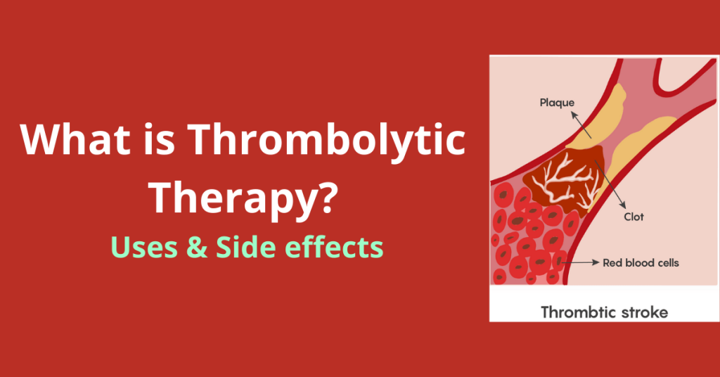 Know What Is Thrombolytic Therapy And Its Uses,Side Effects - Plus100years